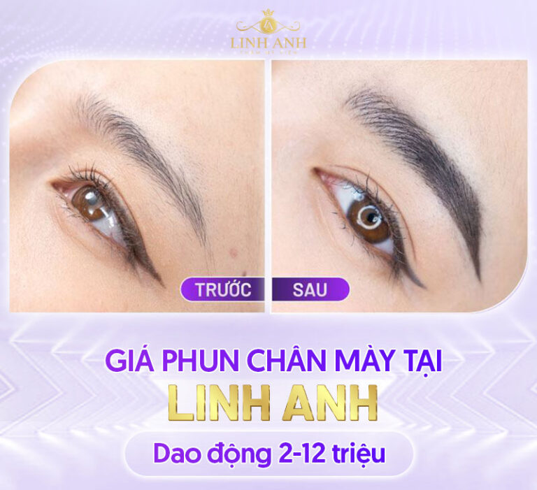 Bảng giá thẩm mỹ viện Linh Anh chi tiết cập nhật 2025