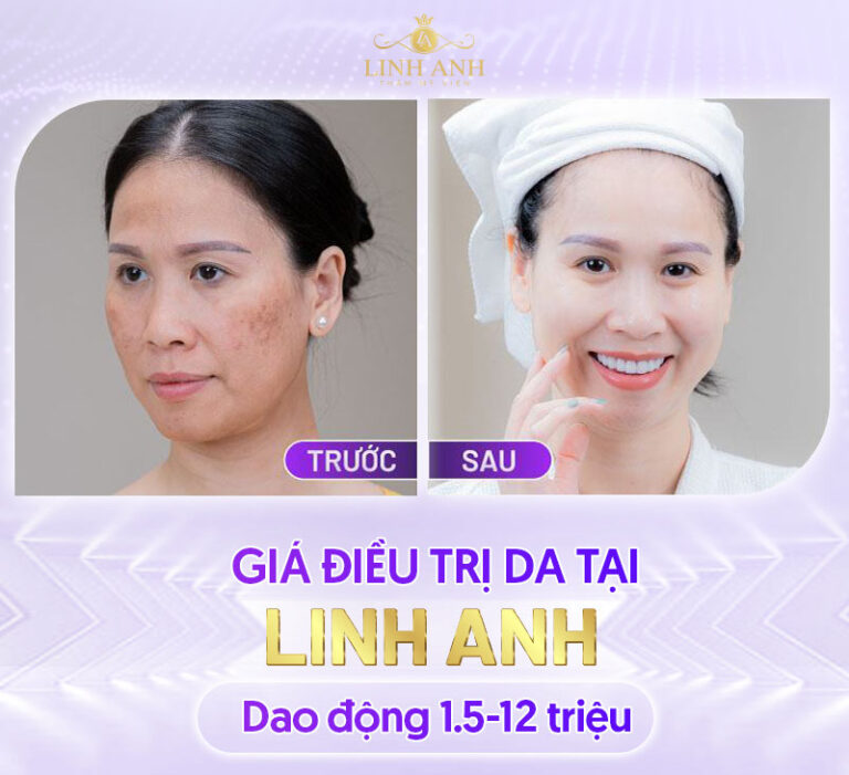 Bảng giá thẩm mỹ viện Linh Anh chi tiết cập nhật 2025