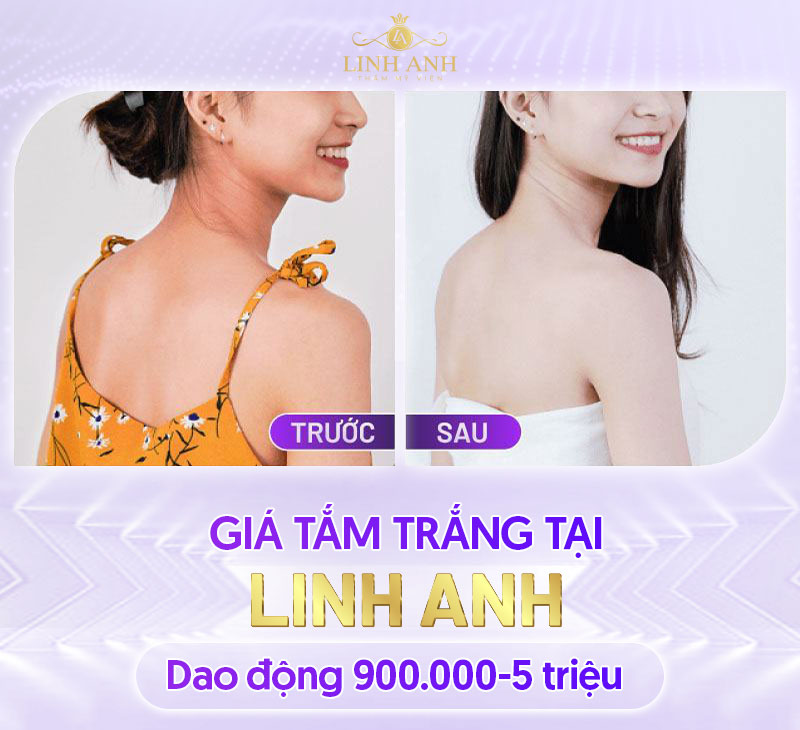 Bảng giá thẩm mỹ viện Linh Anh chi tiết cập nhật 2025