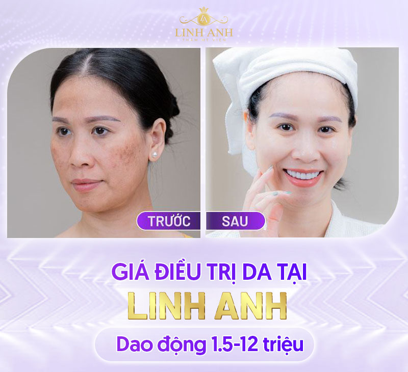 Bảng giá thẩm mỹ viện Linh Anh chi tiết cập nhật 2025