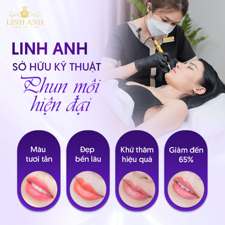 Bảng giá thẩm mỹ viện Linh Anh chi tiết cập nhật 2026