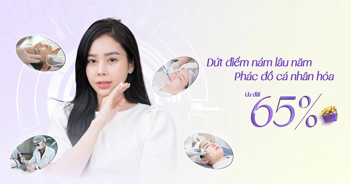 Dịch vụ điều trị nám da công nghệ cao tại Thẩm mỹ Linh Anh