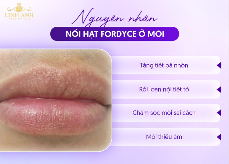 Hạt Fordyce ở môi: Nguyên nhân, cách nhận biết và điều trị